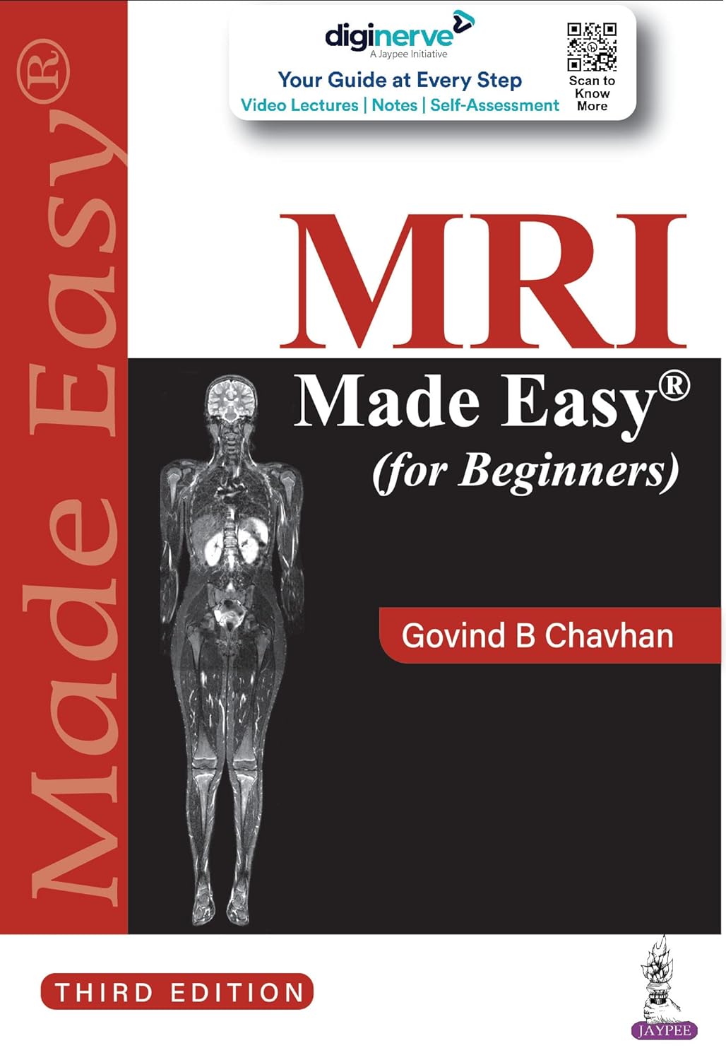 MRI Made Easy (for Beginners) eBook : Chavhan, Govind B: Amazon.in ...