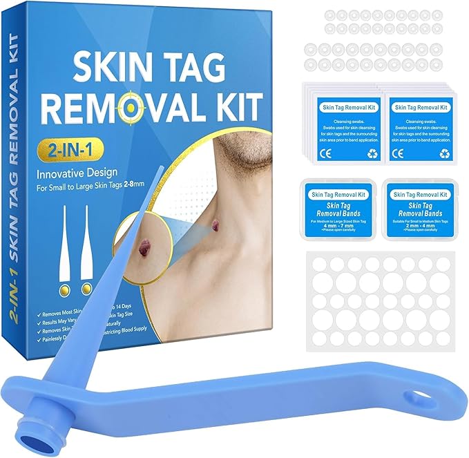 Standard Skin Tag Tool Kit Quick and Painless Solution for Medium to ...