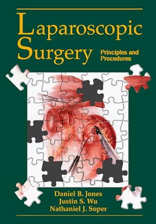 Laparoscopic Surgery: Principles and Procedures: 9781576260074 ...