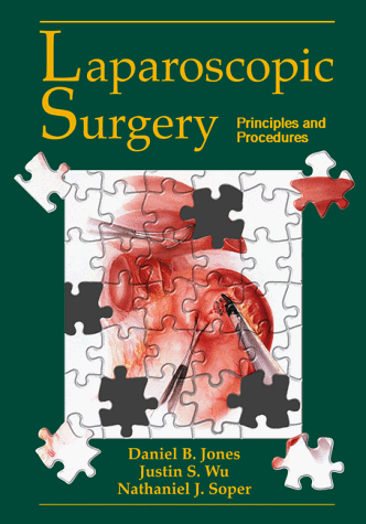 Laparoscopic Surgery: Principles and Procedures: 9781576260074 ...