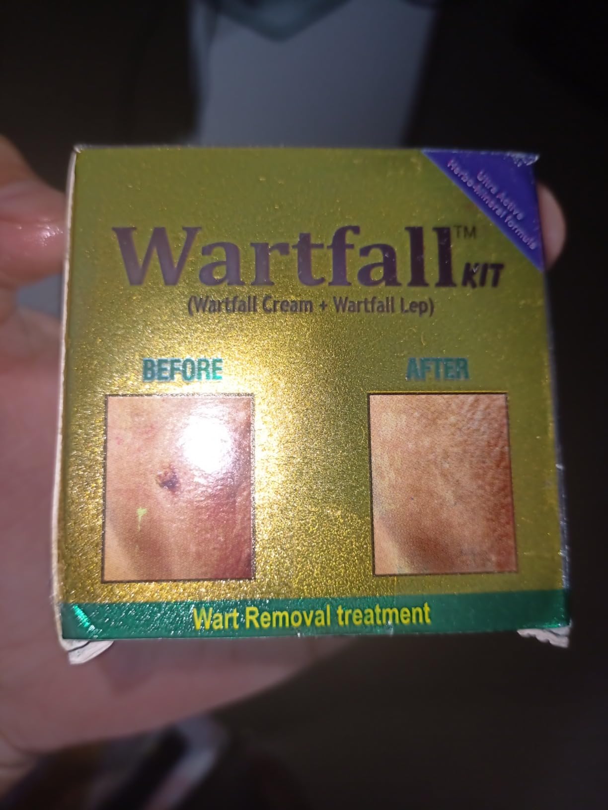 Buy All New WARTFALL™ Herbal Wart Removal Cream | Fast-Acting Formula ...