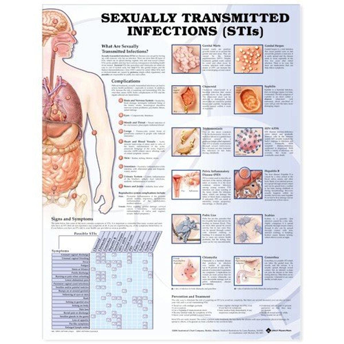 Sexually Transmitted Infections Anatomical Chart: (laminated) | Amazon ...