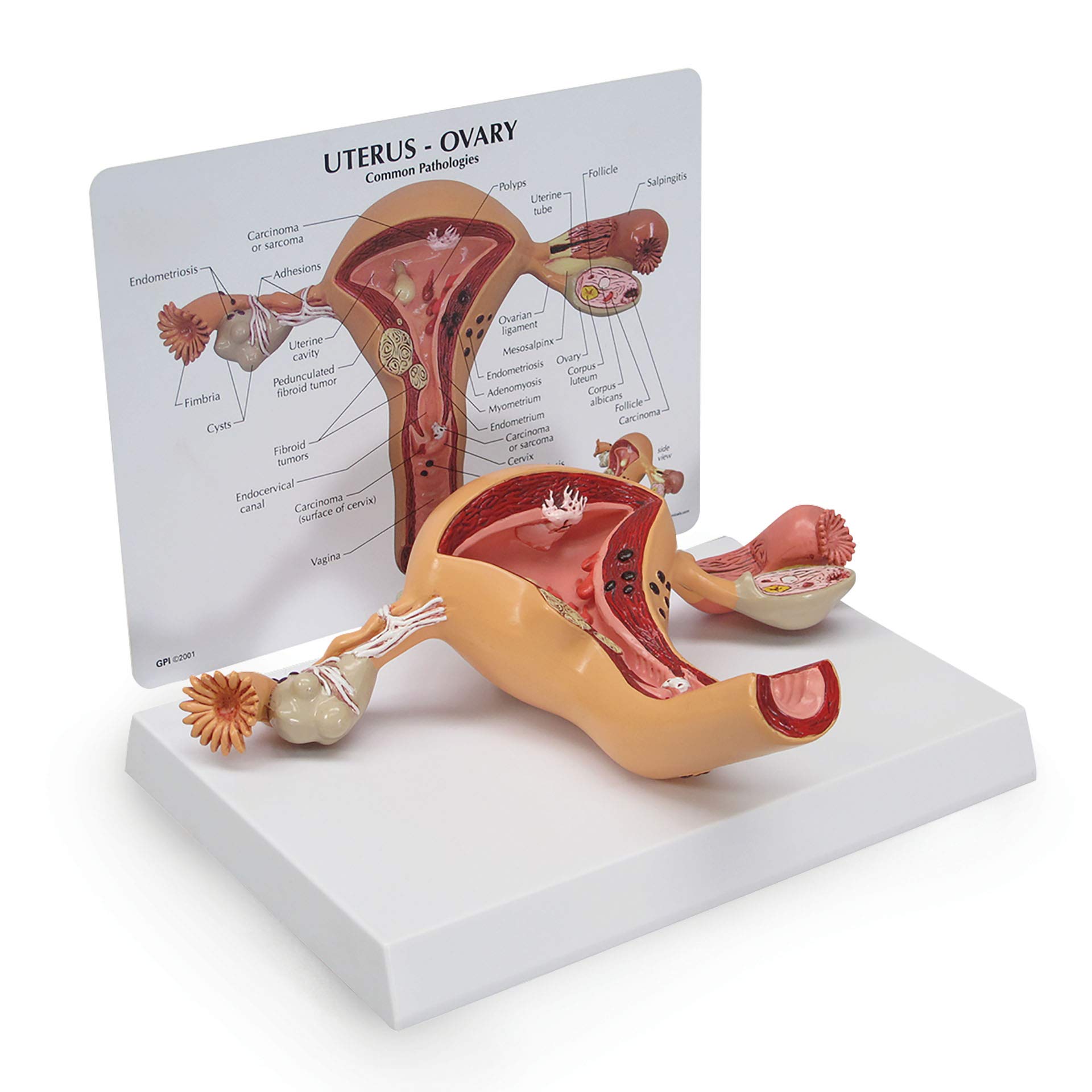 Buy Uterus Ovary Model Human Body Anatomy Replica Of Female 