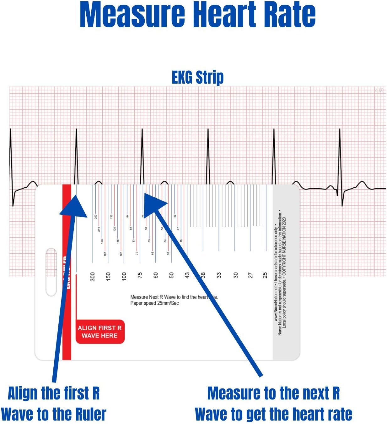 6 Card EKG Set with Ruler, Interpretations, Findings, STEMI Leads ...