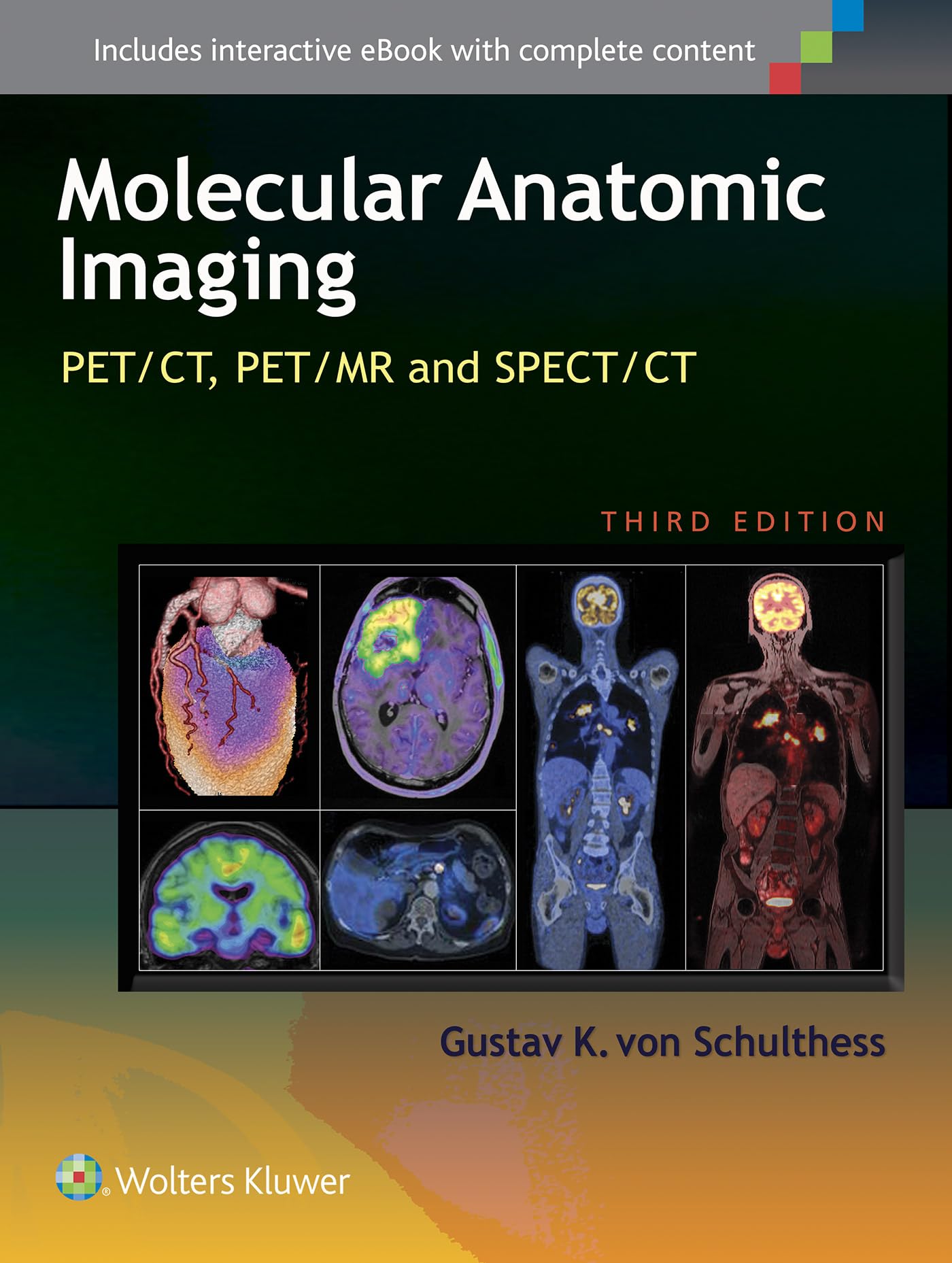 Molecular Anatomic Imaging: PET/CT, PET/MR and SPECT CT: 9781451192667 ...