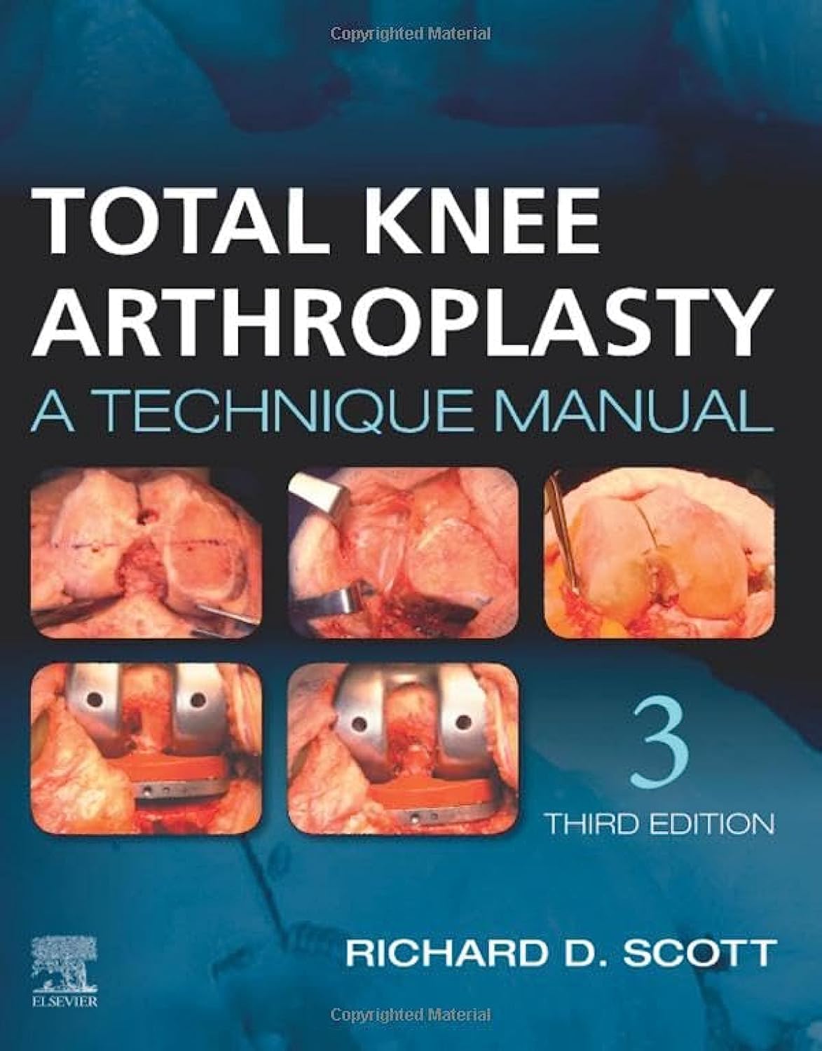 Total Knee Arthroplasty: A Technique Manual: 9780323710657: Medicine ...