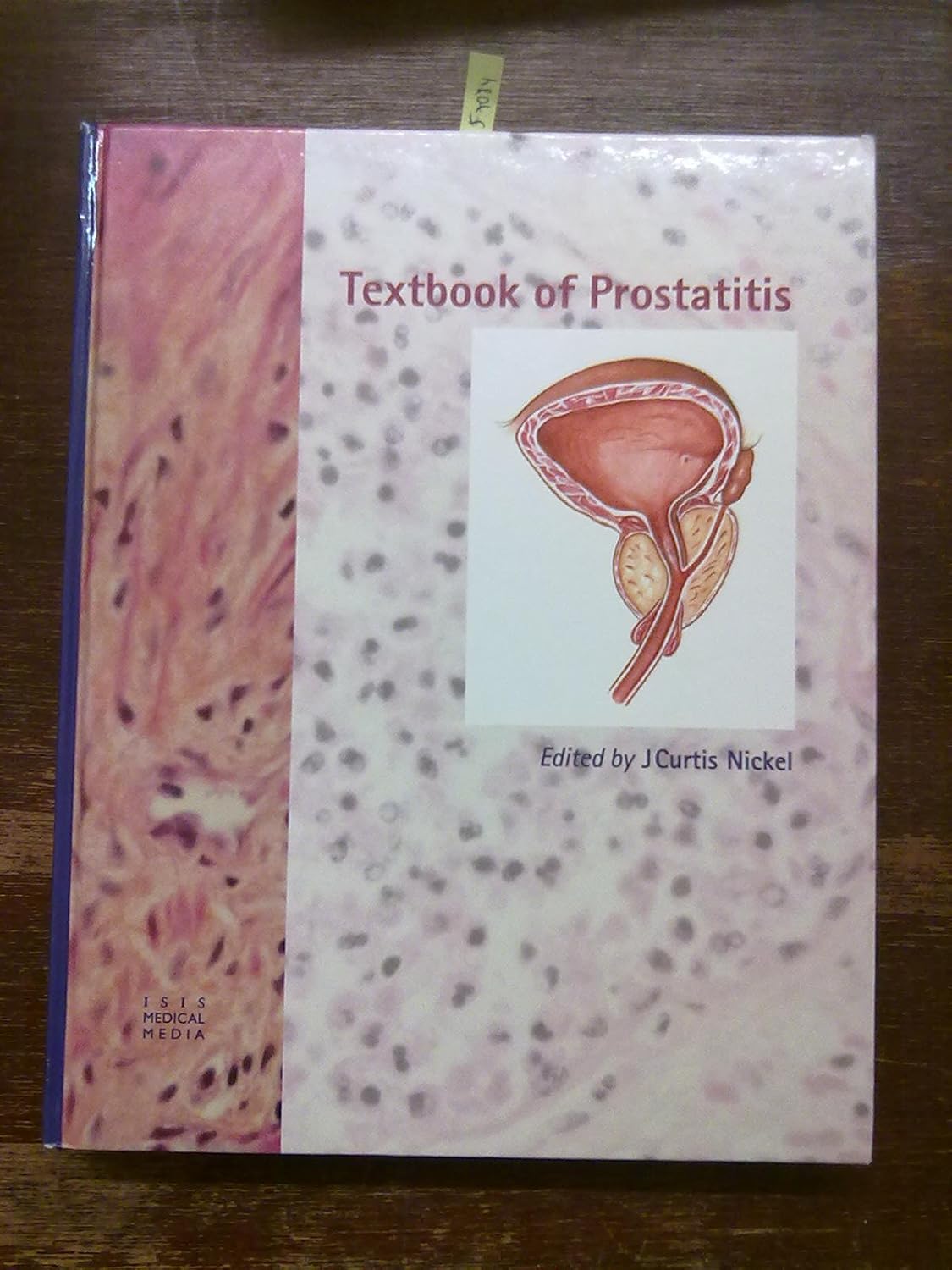 Textbook of Prostatitis: 9781901865042: Medicine & Health Science Books ...