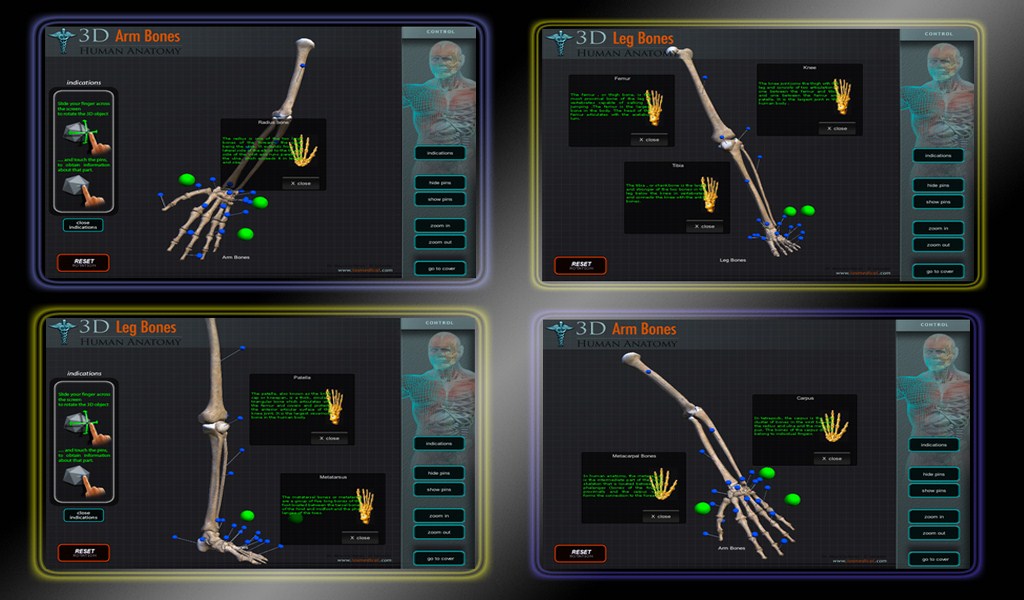 Anatomy arm and leg 3D - App on Amazon Appstore