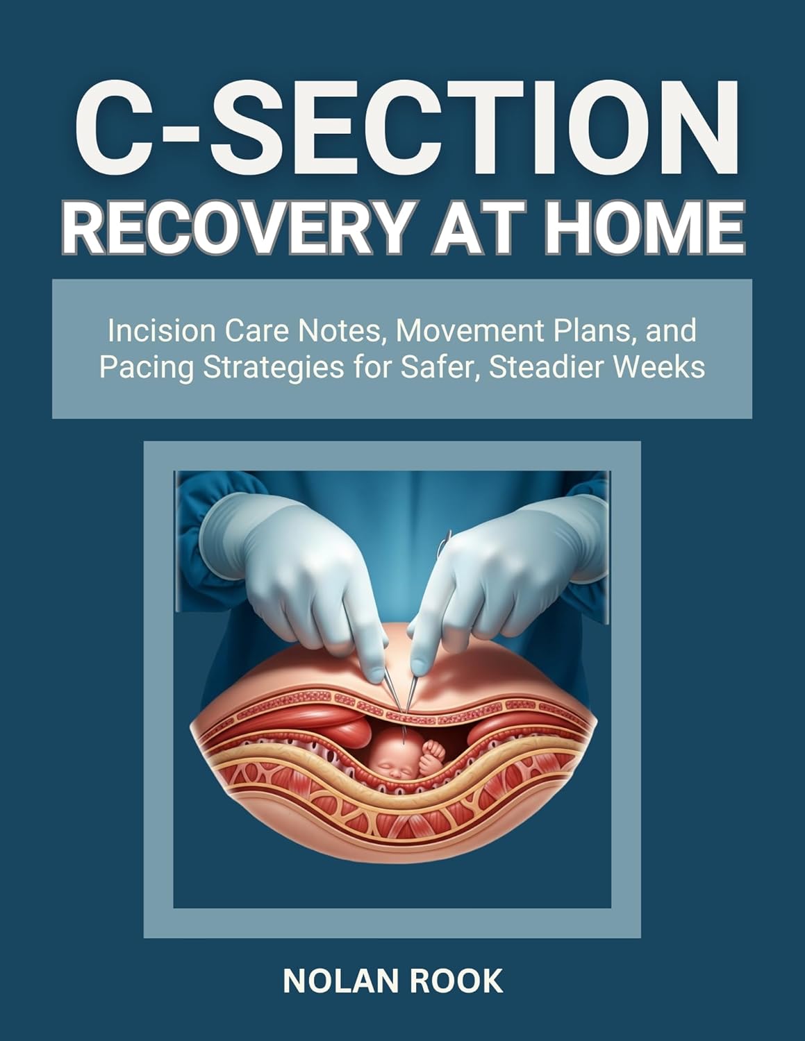 C-SECTION RECOVERY AT HOME : Incision care notes, movement plans, and ...