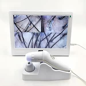 Amazon.com: Scalp Camera for Hair and Skin Analysis - 13-Inch Hair ...
