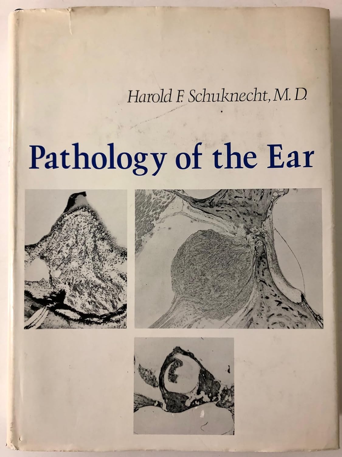 Pathology of the Ear (Commonwealth Fund Publications): 9780674657885 ...