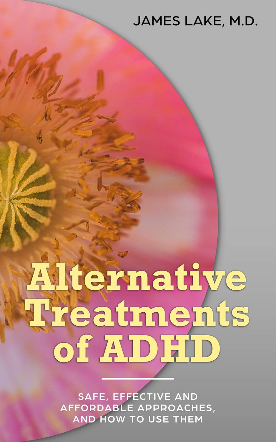 Amazon | Alternative Treatments of Attention-deficit Hyperactivity ...