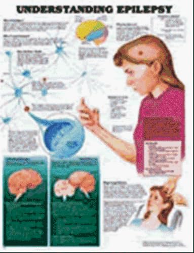 Amazon.com: Understanding Epilepsy Anatomical Chart: Industrial ...