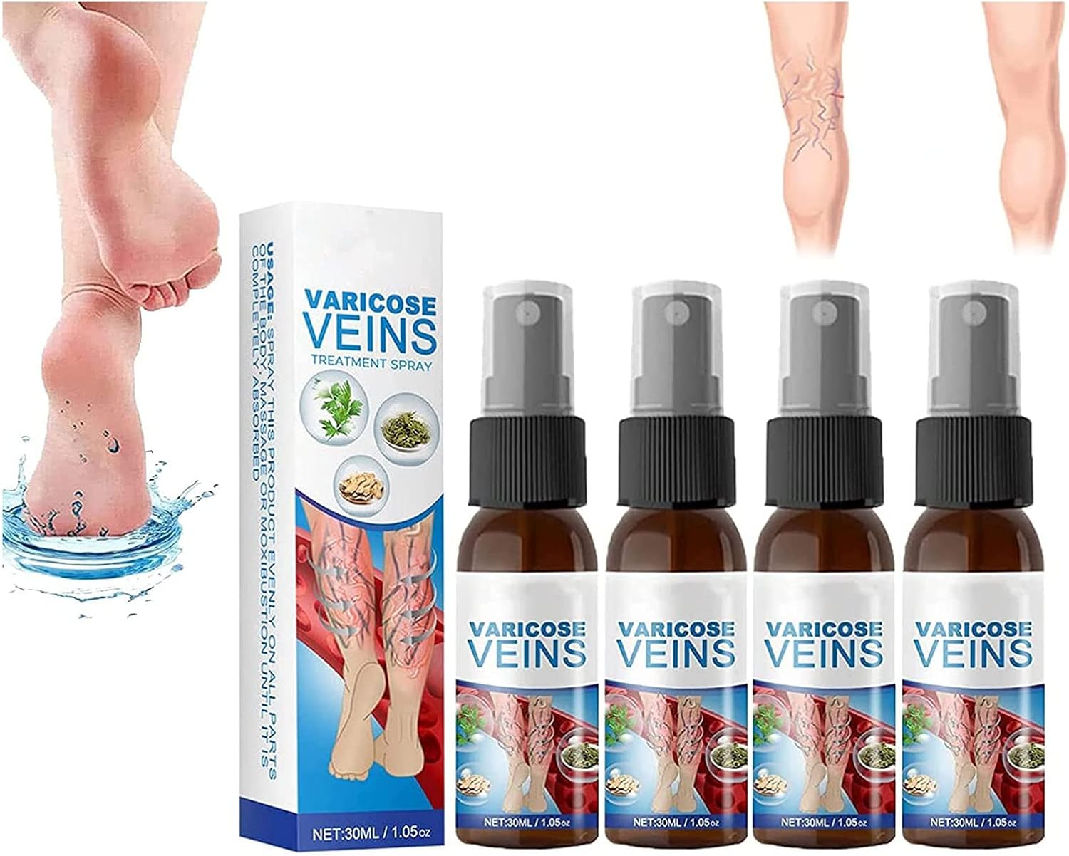 Varicose Veins Miracle Spray,Varicose Veins Cream,Varicose Vein ...