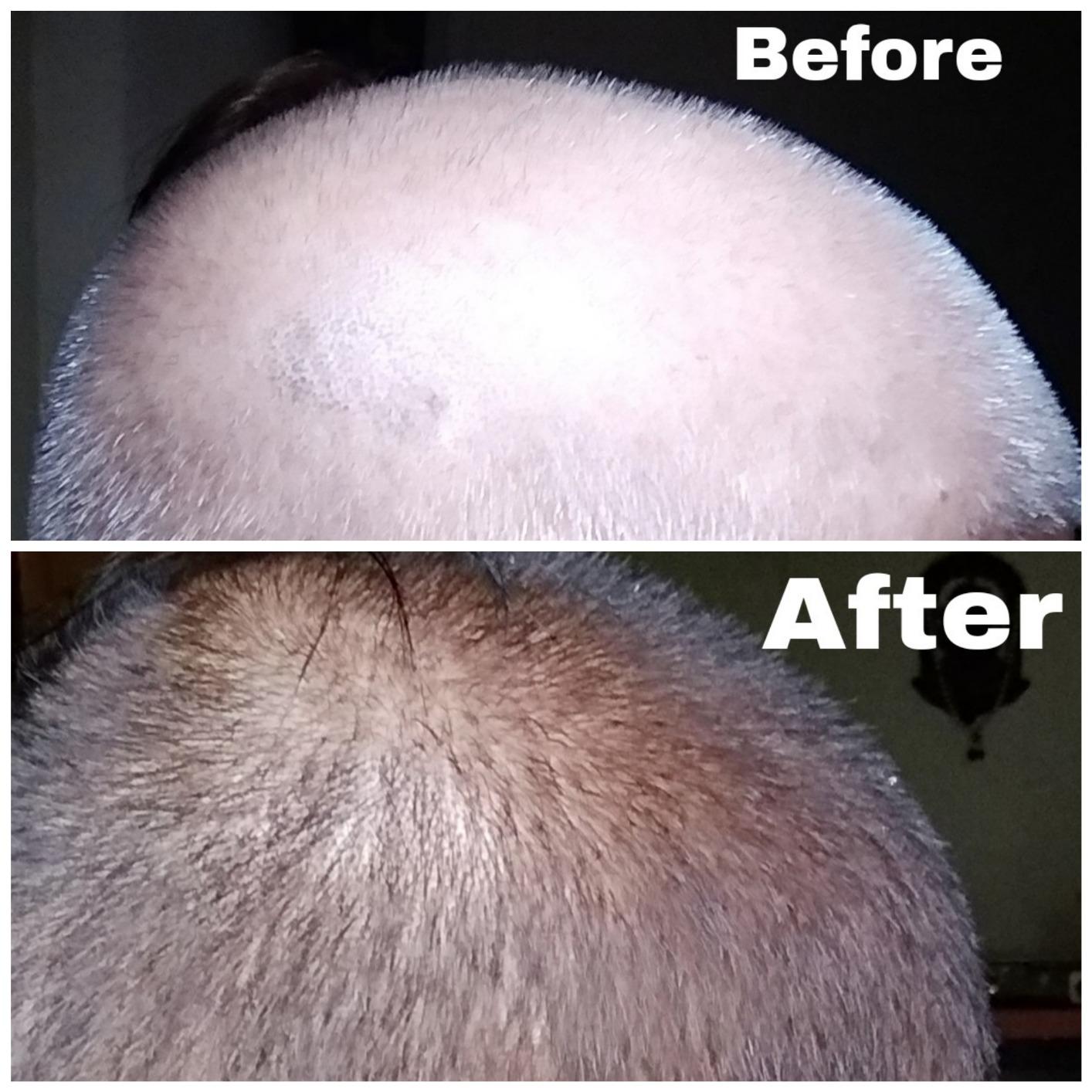 Buy Swarzstar Hair Color Shampoo Black- Noni Extract 125 ml (Pack of 5 ...