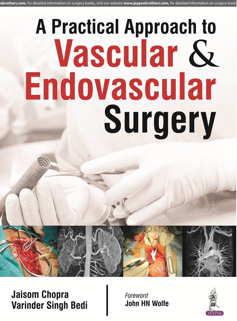 Practical Approach to Vascular & Endovascular Surgery, a: 9789351529958 ...