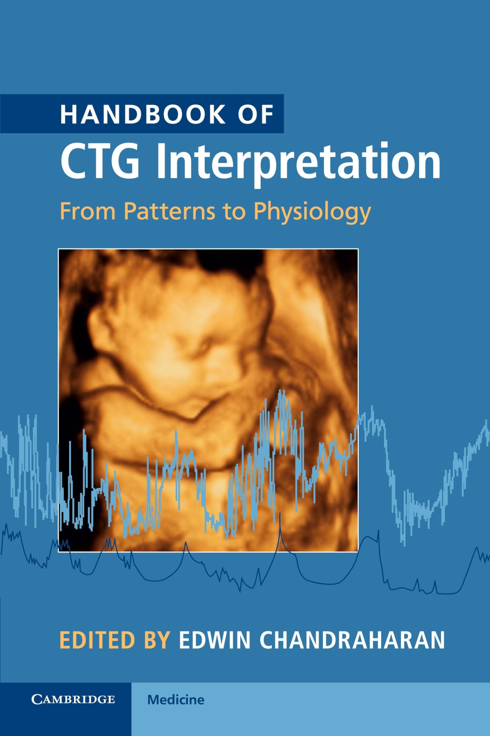 Handbook of CTG Interpretation: 9781107485501: Medicine & Health ...