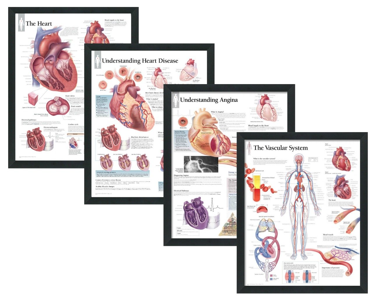 Buy Set of 4 Framed Medical s The Heart Understanding Heart Disease ...
