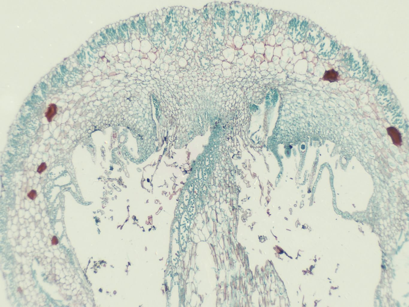 Marchantia Sporophyte Slide
