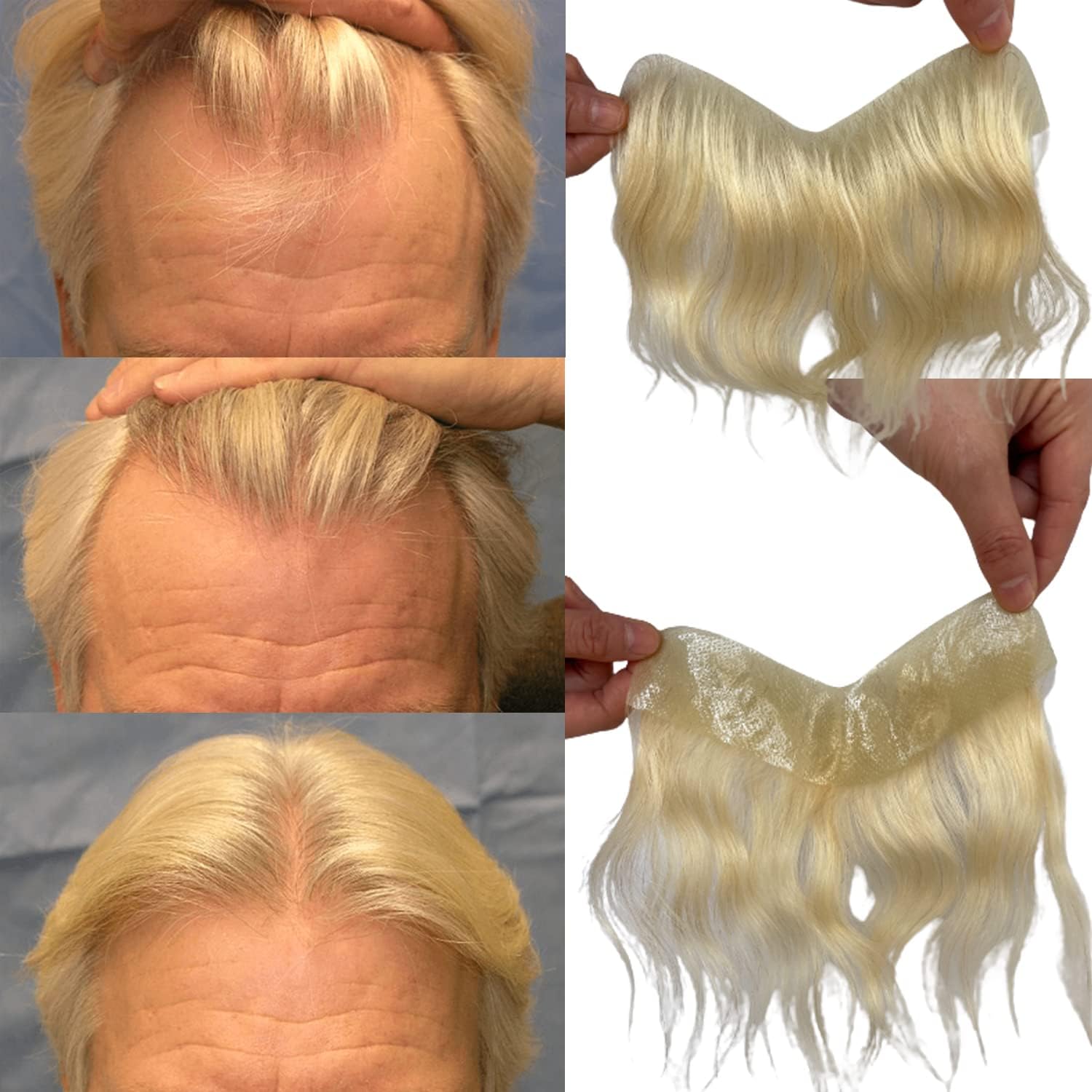 Amazon.com : Voloria Men Forehead Hairline Toupee 100% Human Hair Skin ...