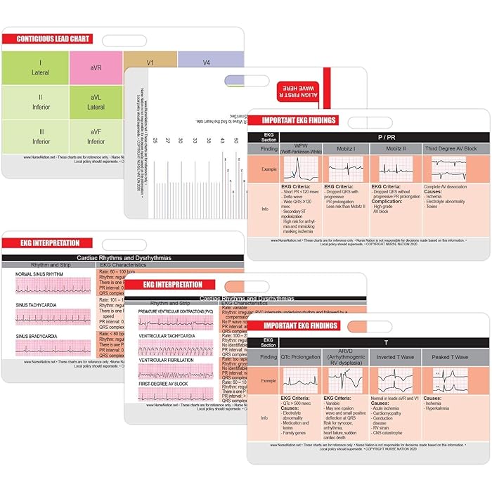Buy EKG Horizontal Badge 6 Card Set, ECG Telemetry Cards with EKG Ruler ...