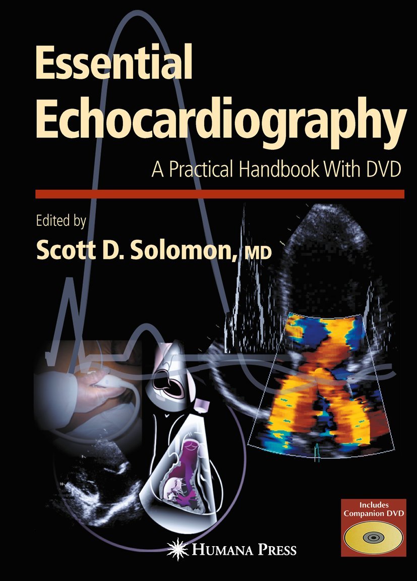 Essential Echocardiography: A Practical Handbook with DVD (Contemporary ...