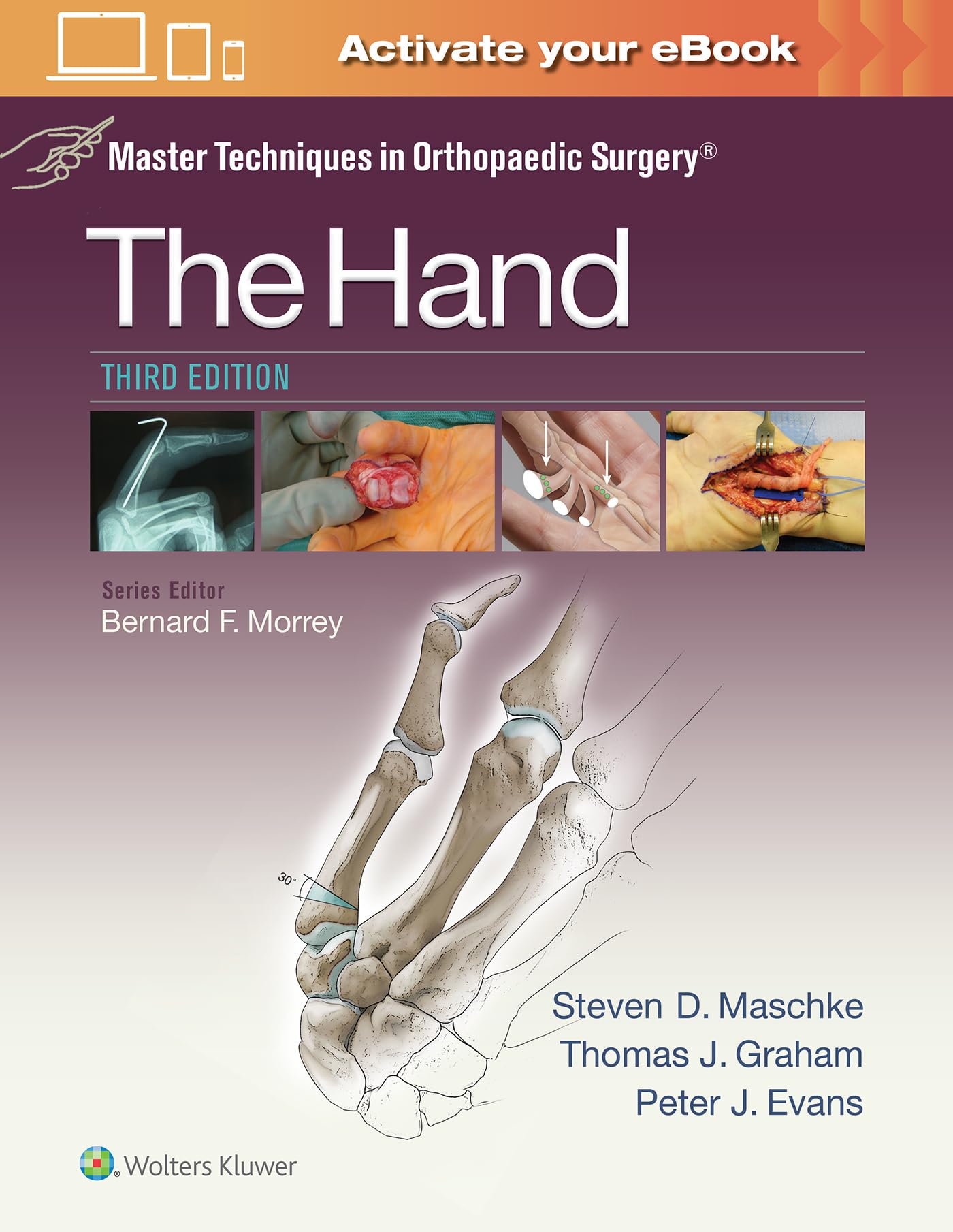 Master Techniques in Orthopaedic Surgery: The Hand: 9781451182781 ...