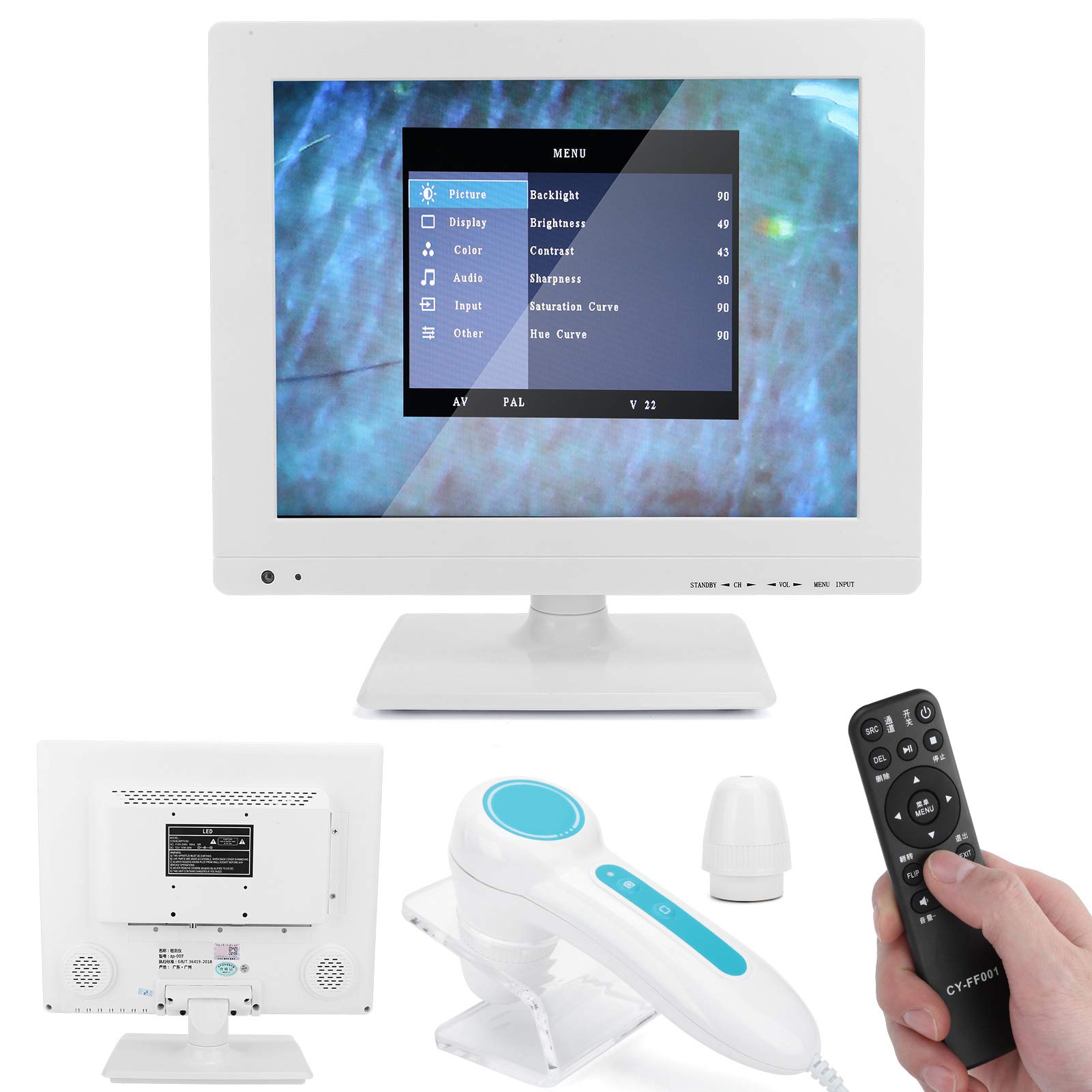 Buy Skin Diagnosis Hair Analyzer,15 inch 100X High Definition Charging ...