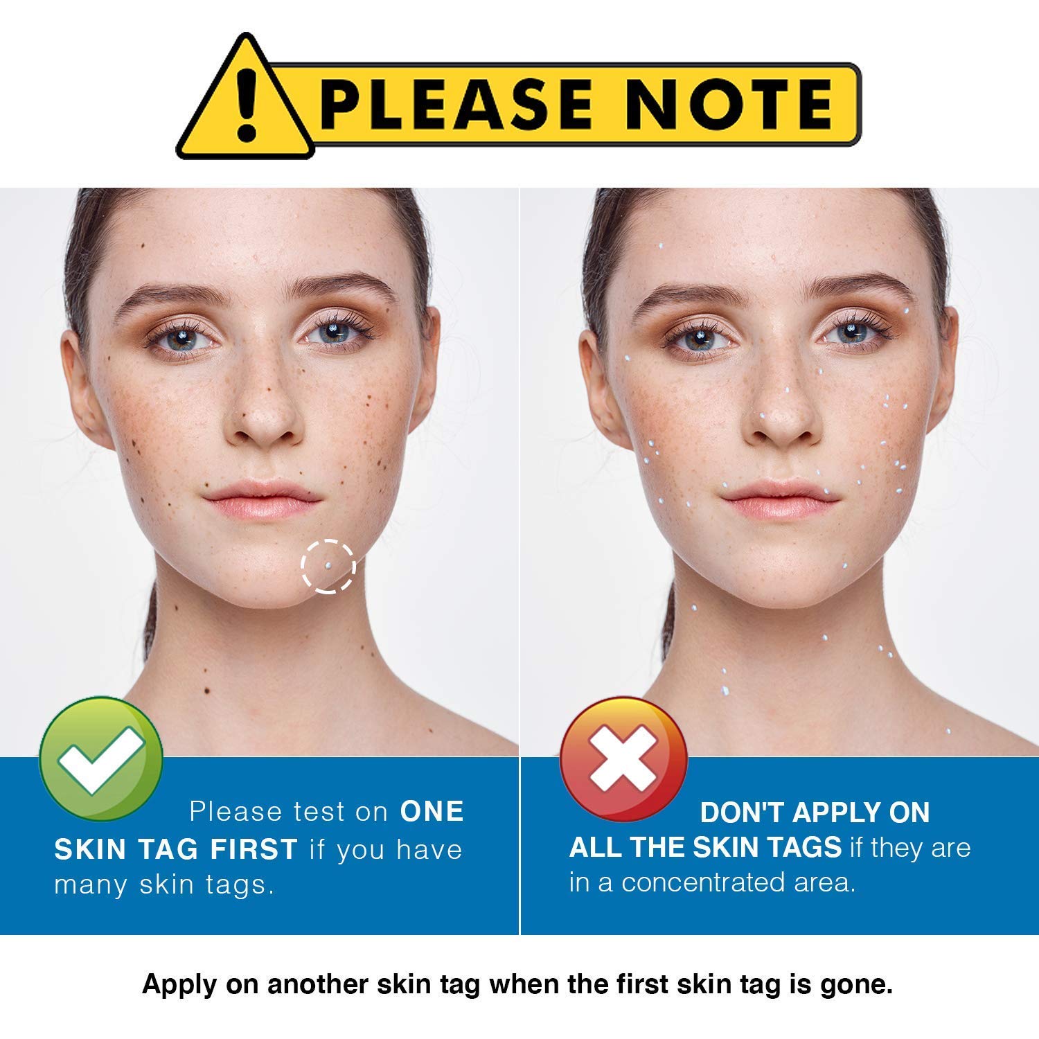 Azally Mole Corrector & Skin Tag Remover Cream with Repair Gel, Remove ...