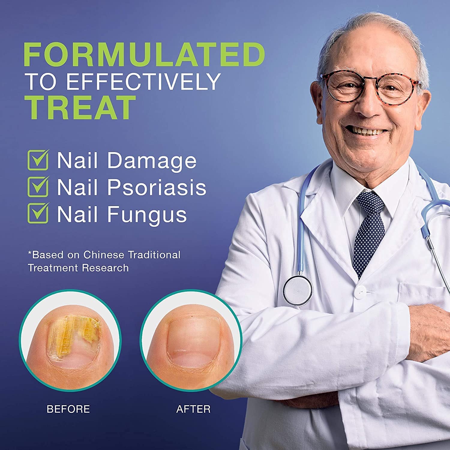 Snapklik.com : Extra Strength Toenail Fungus Treatment For Toenail Or ...