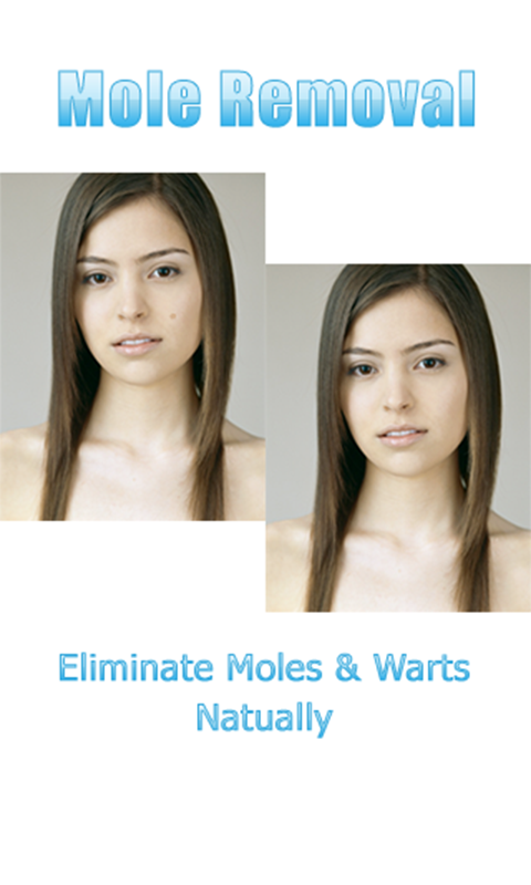 Mole Removal - Eliminate Moles and Warts Naturally - App on Amazon Appstore