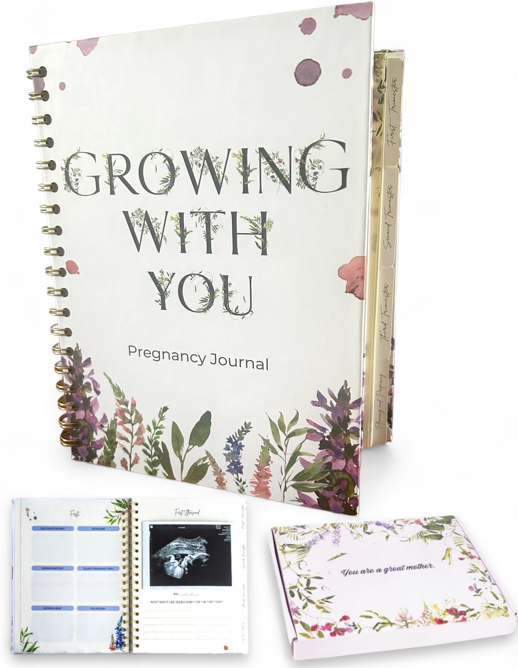 Amazon.com: Pregnancy Journal w/ 200+ pages | Pregnancy Scrapbook ...