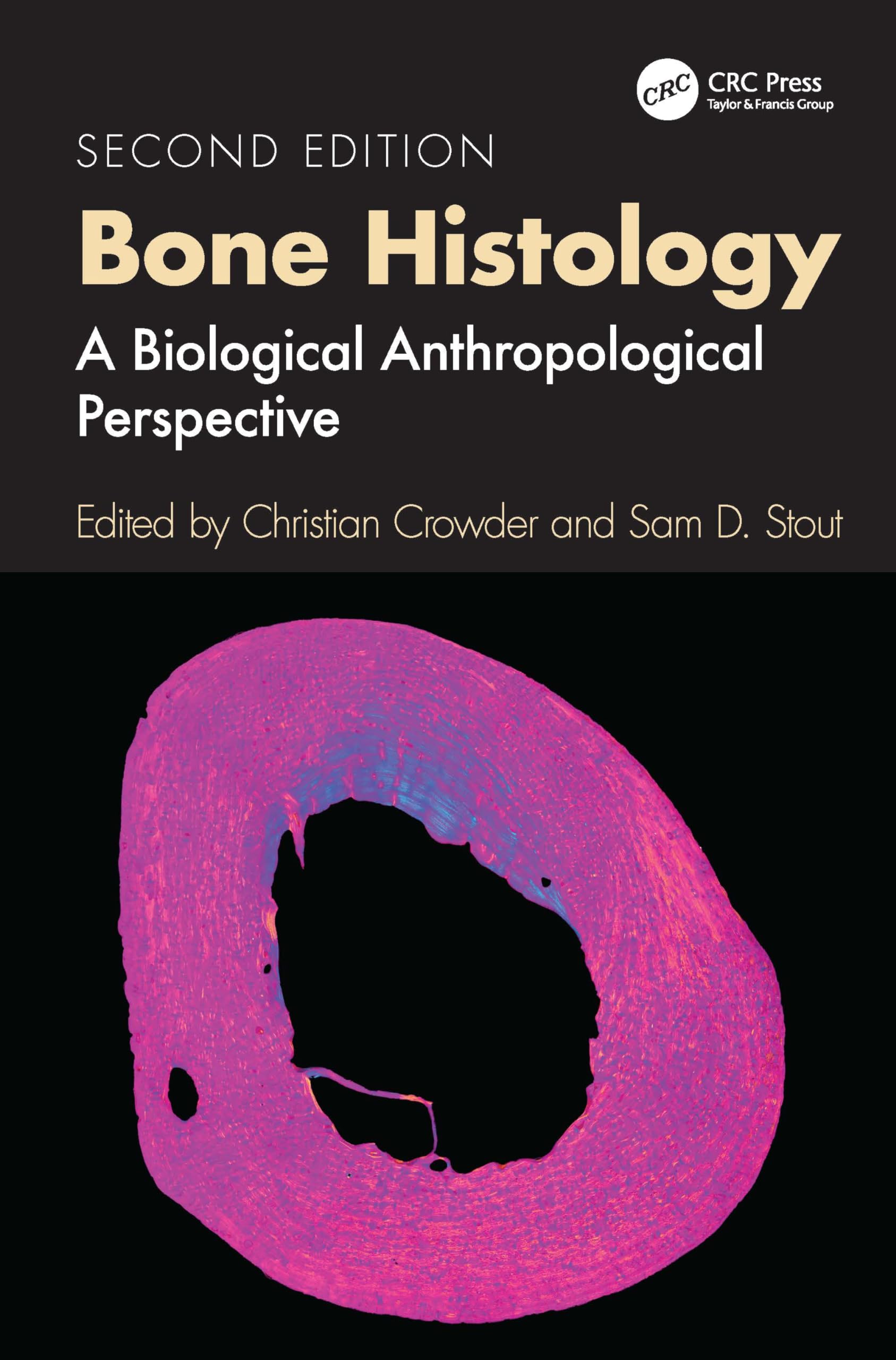 Bone Histology: A Biological Anthropological Perspective: 9781032473277 ...