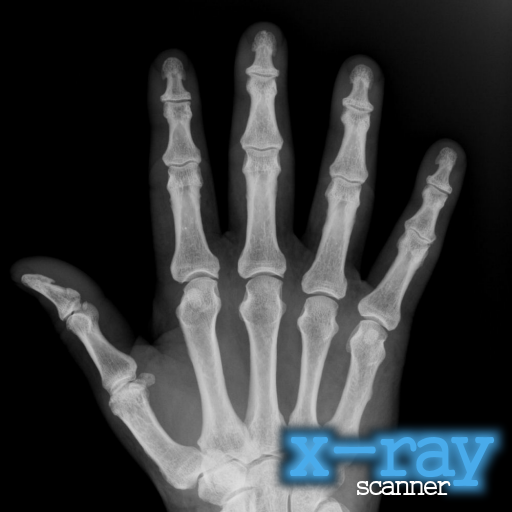 X-Ray Scanner (Ad-Free) - App on Amazon Appstore