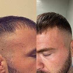 Amazon.com : hims Thick Fix Hair Thickening Shampoo for Thinning Hair ...