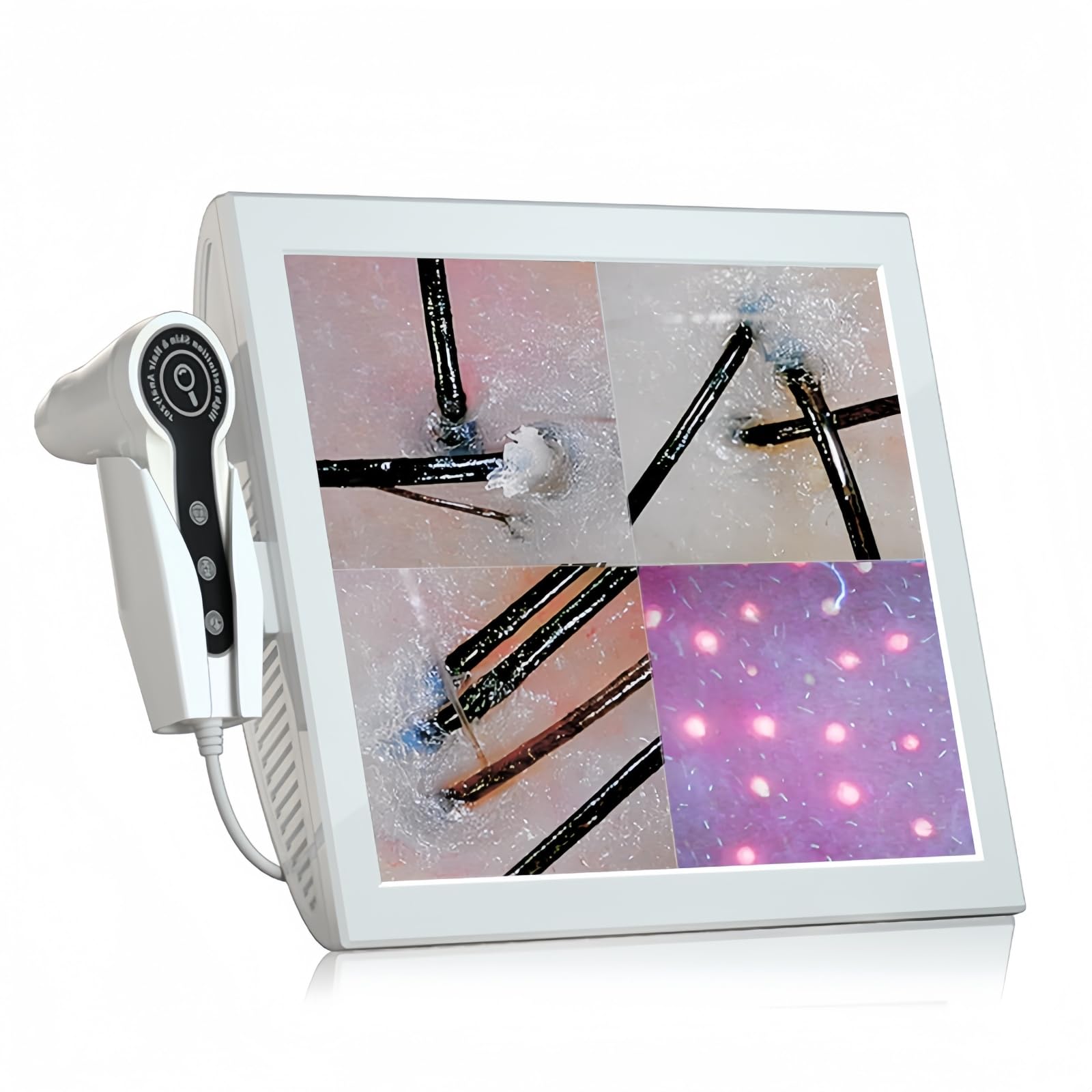 Amazon.com : Professional 15-Inch Scalp Camera for Beauty Salons – High ...