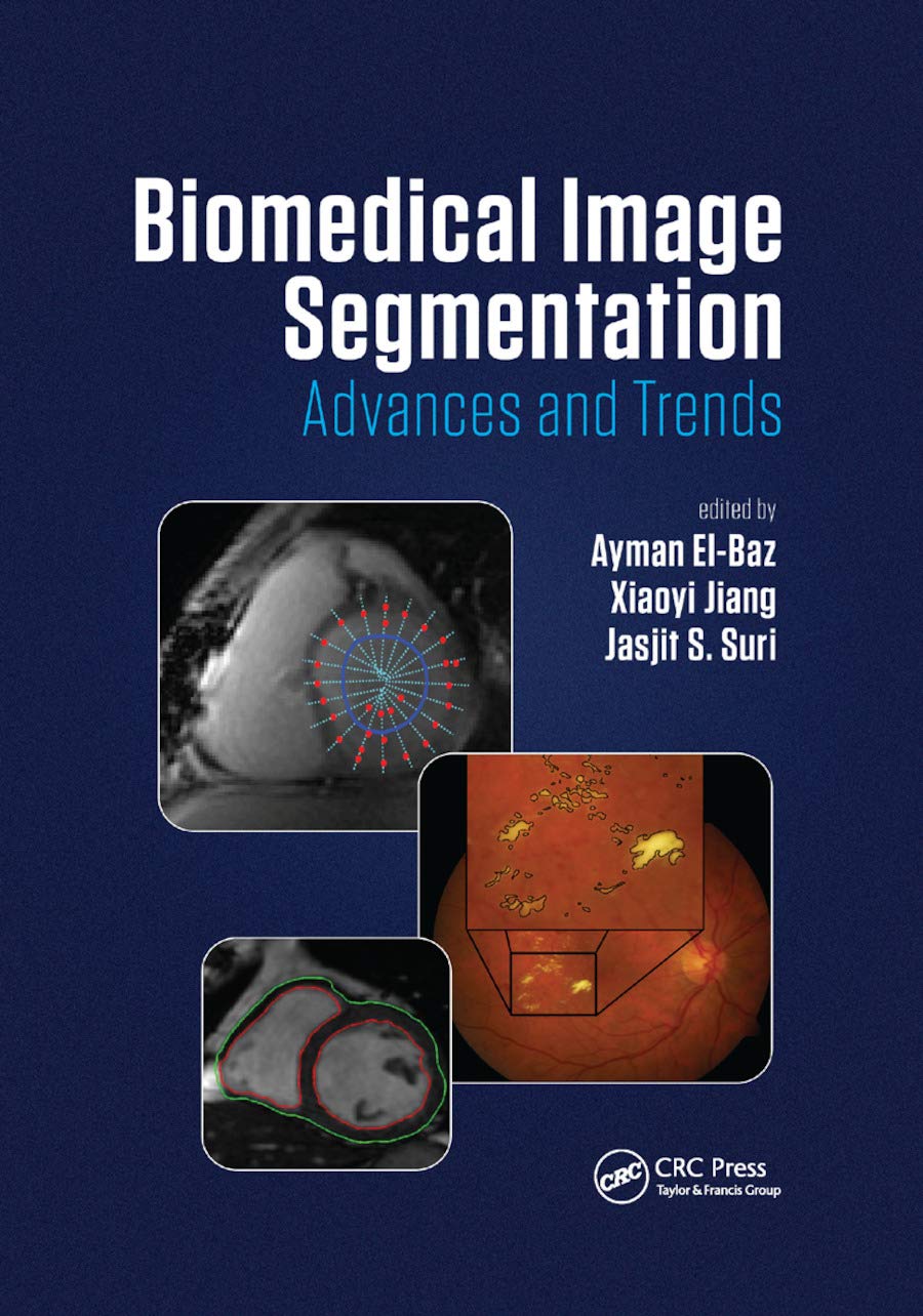Biomedical Image Segmentation: Advances and Trends: 9780367870867 ...
