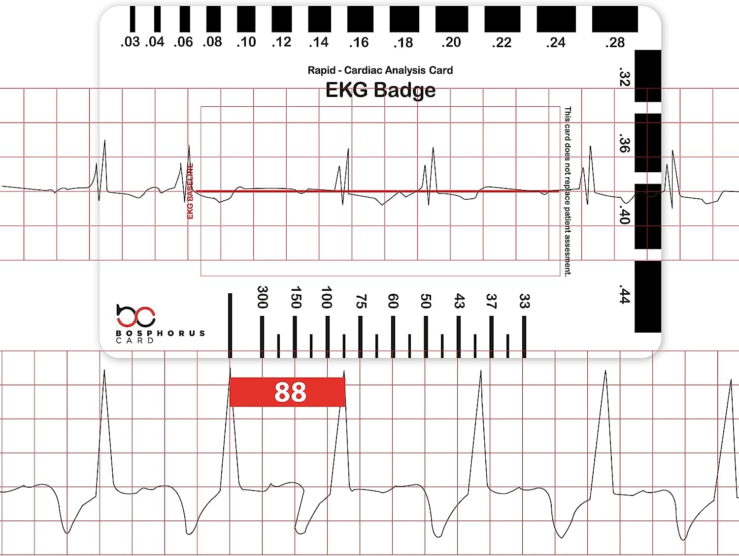 Snapklik.com : EKG PVC Badge Card Accurately Interpret ECG/EKG Rhythm ...