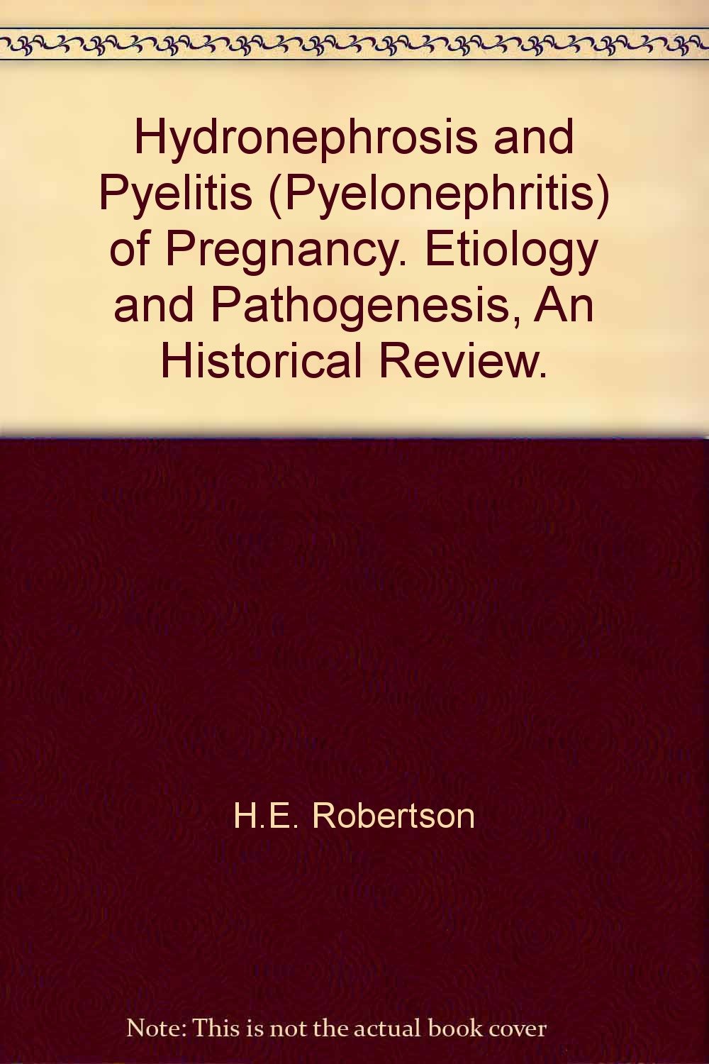 Buy Hydronephrosis and Pyelitis (Pyelonephritis) of Pregnancy. Etiology ...