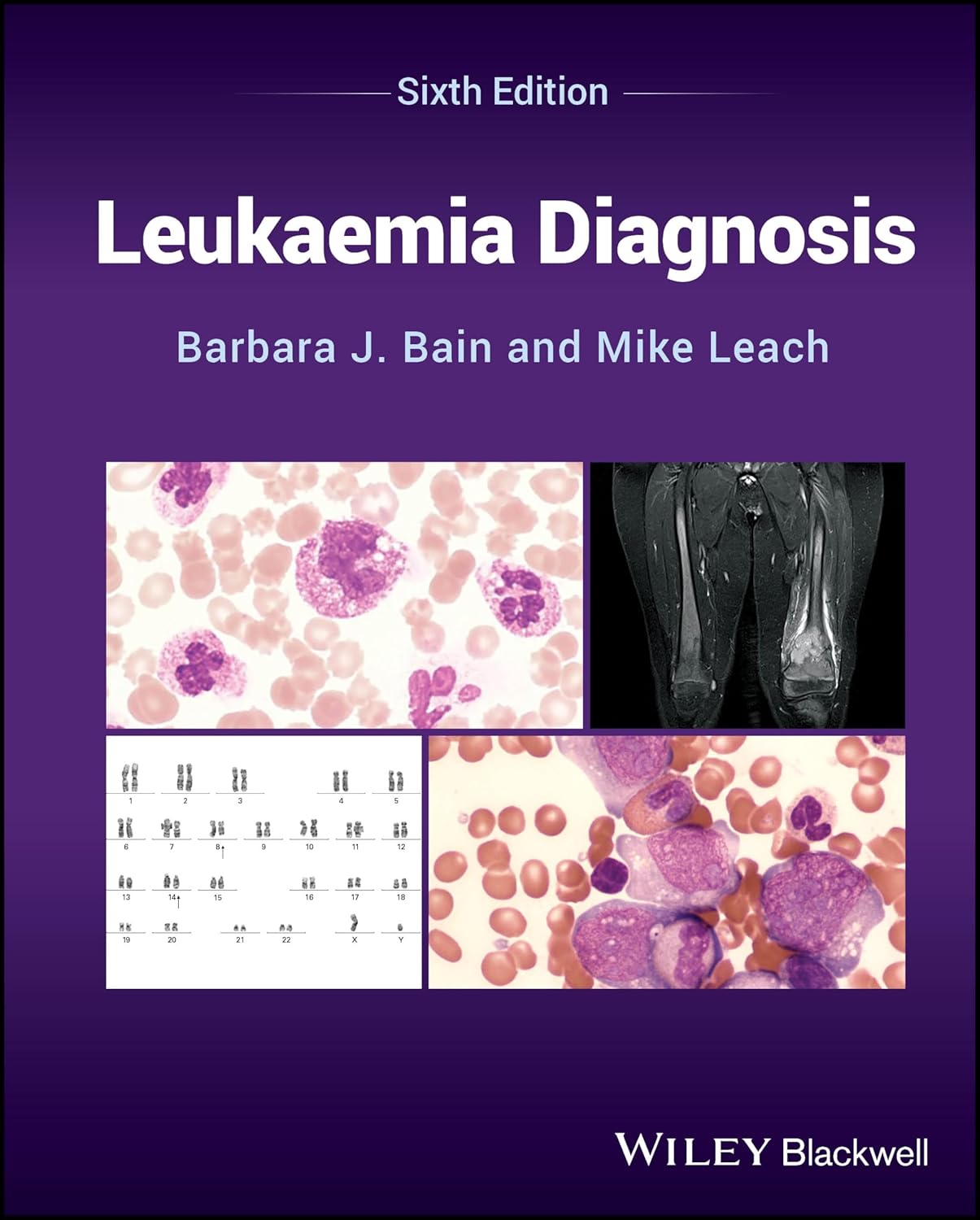 Leukaemia Diagnosis: 9781394218585: Medicine & Health Science Books ...