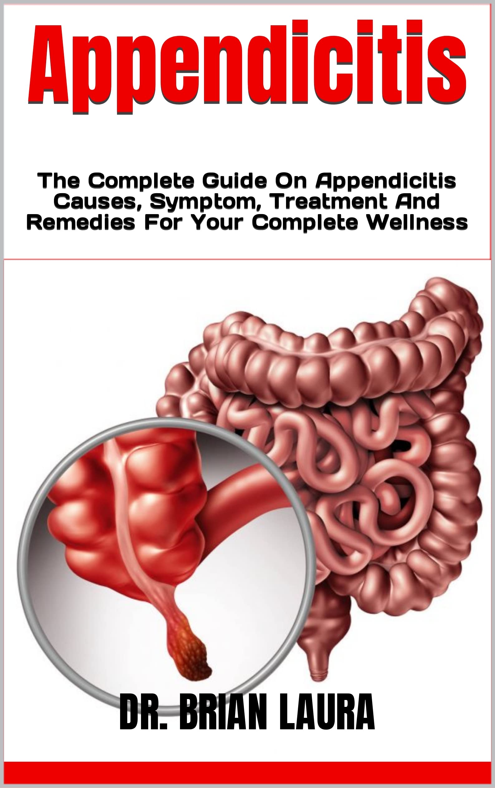 Buy Appendicitis : The Complete Guide On Appendicitis Causes, Symptom ...