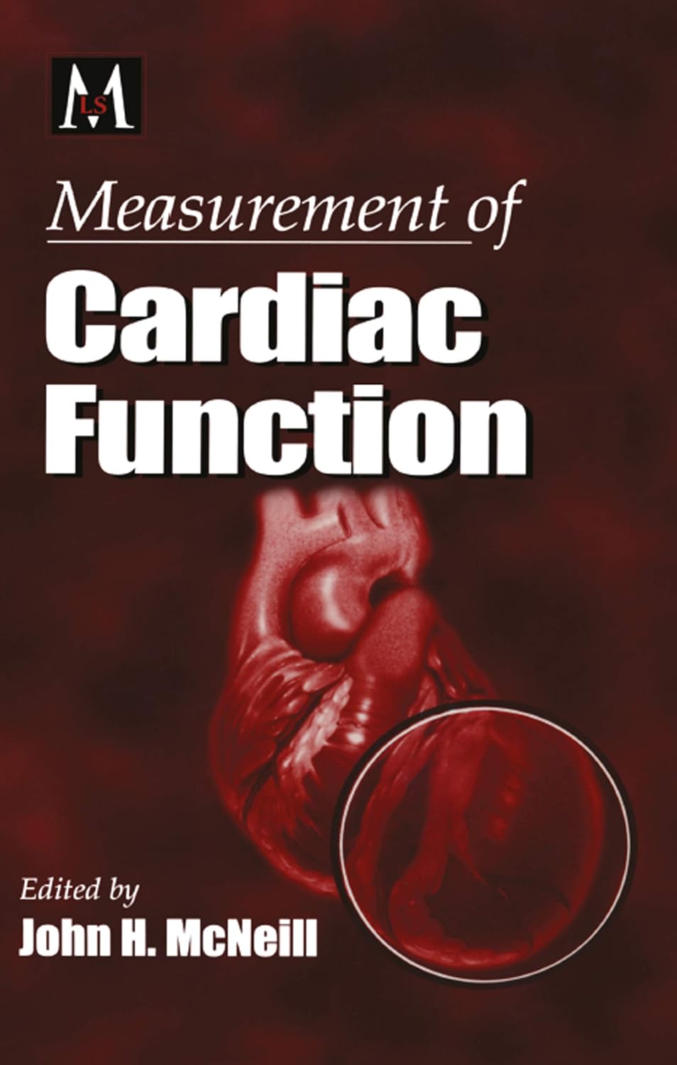 Amazon.com: Measurement of Cardiac Function: Approaches, Techniques ...