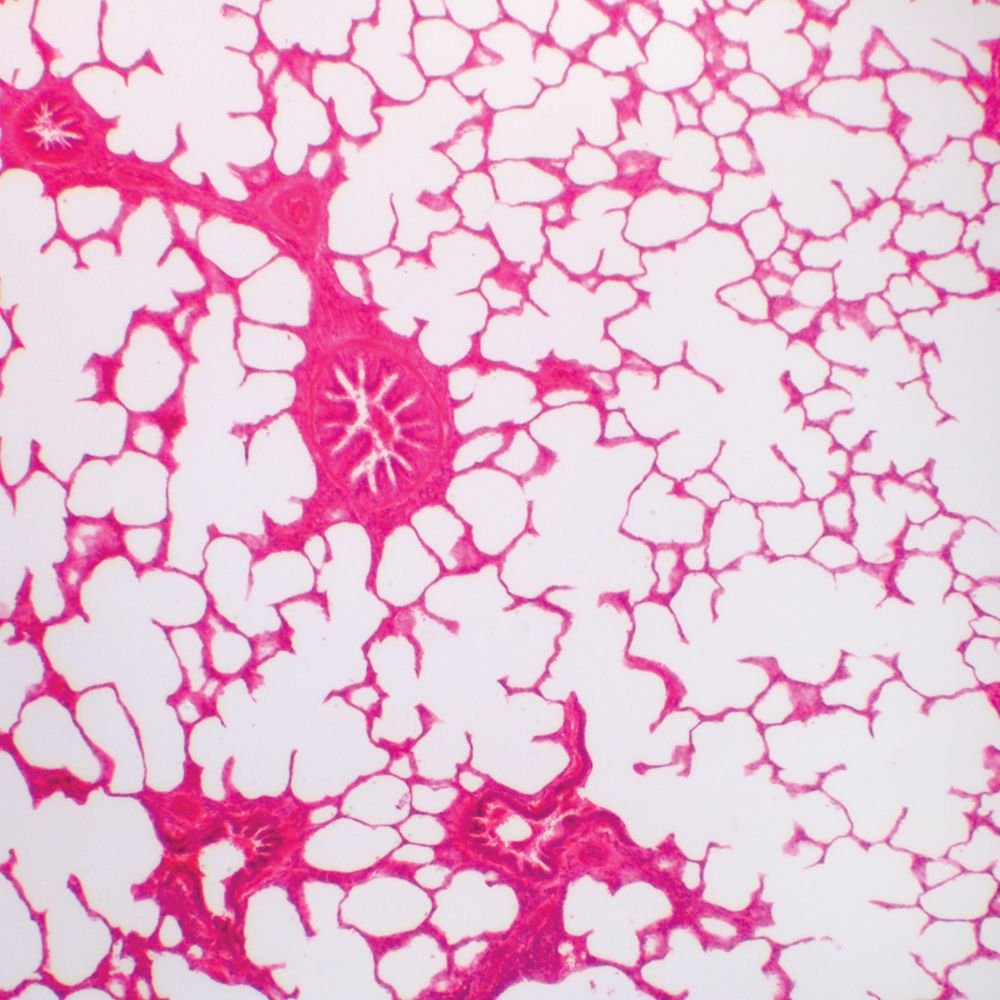 Alveoli Slide