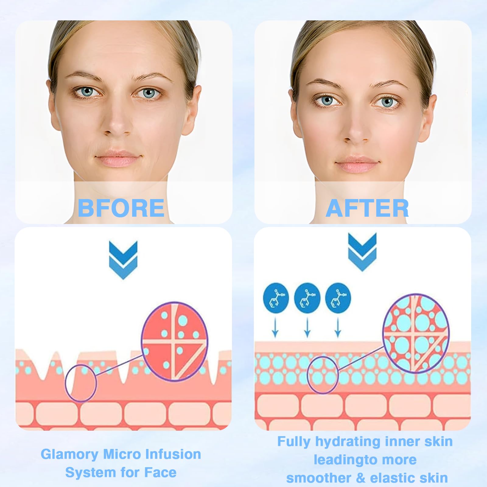 Colaren Micro Infusion Facial System, Anting Wrinkle Beauty Micro ...