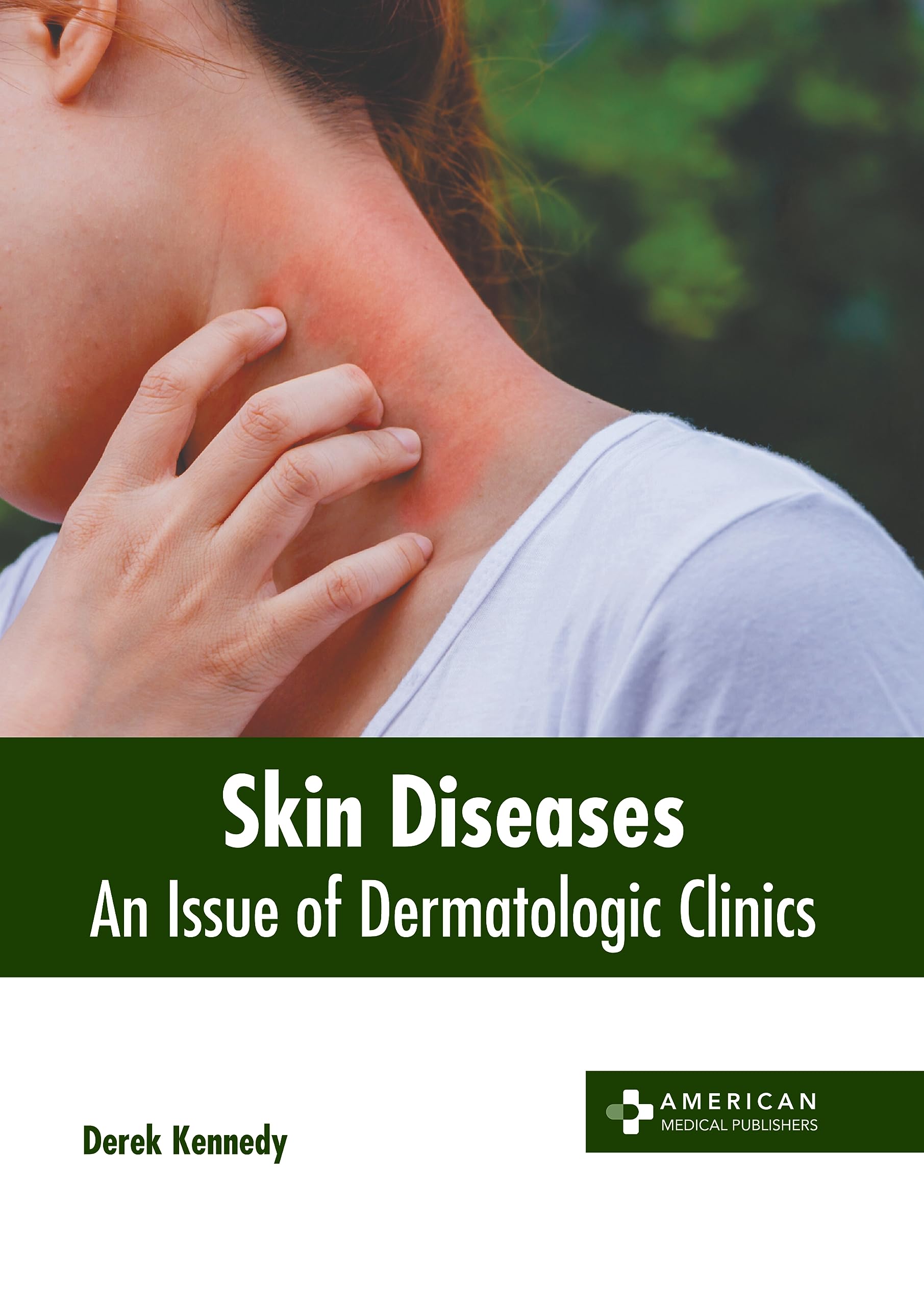 Skin Diseases: An Issue of Dermatologic Clinics: 9798887404585 ...