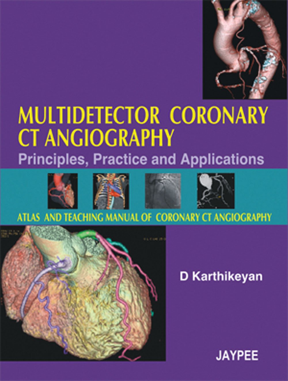 Buy Multidetector Coronary Ct Angiography Principles,Practice And ...