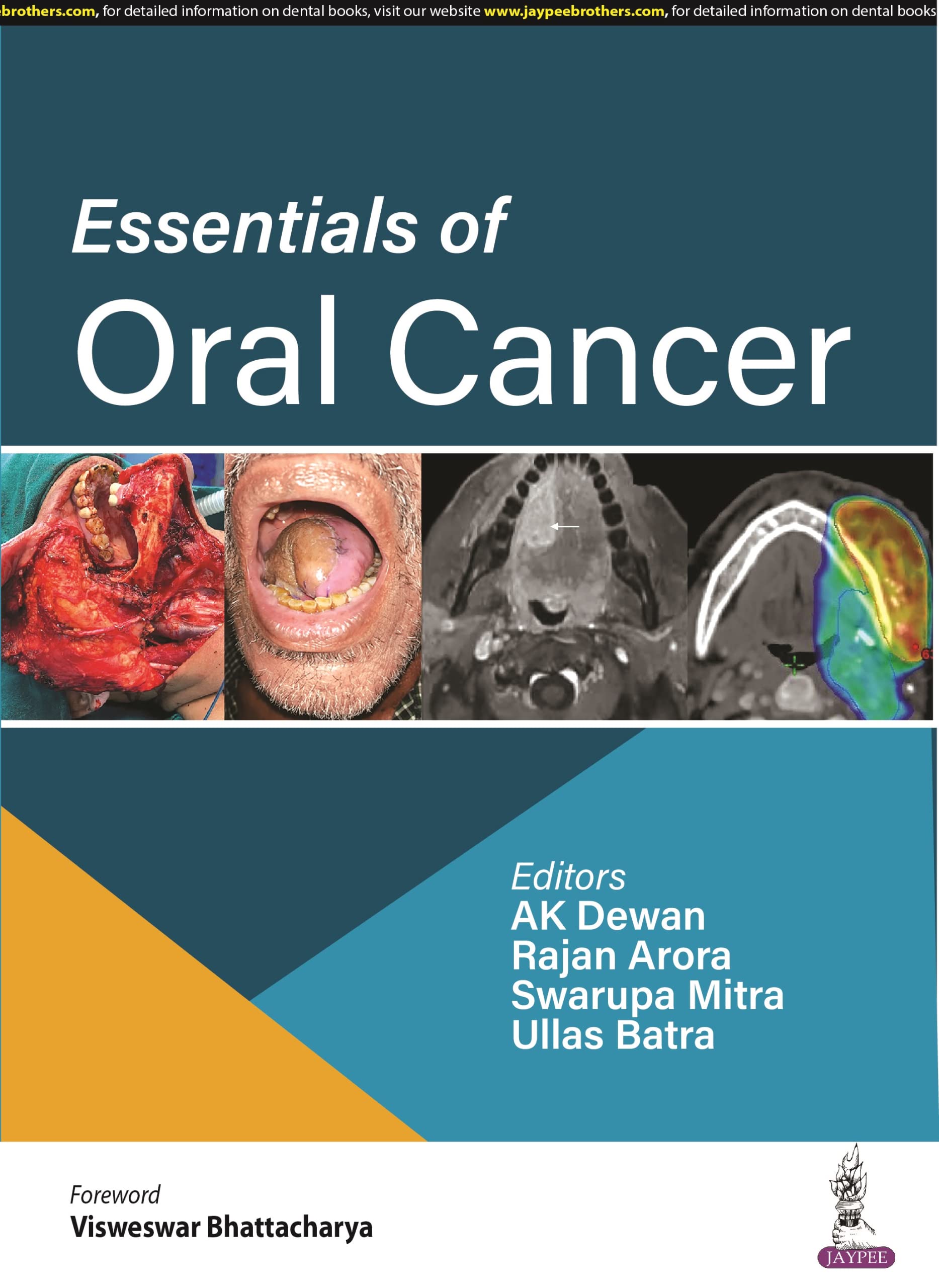 Essentials of Oral Cancer: 9789354650819: Medicine & Health Science ...