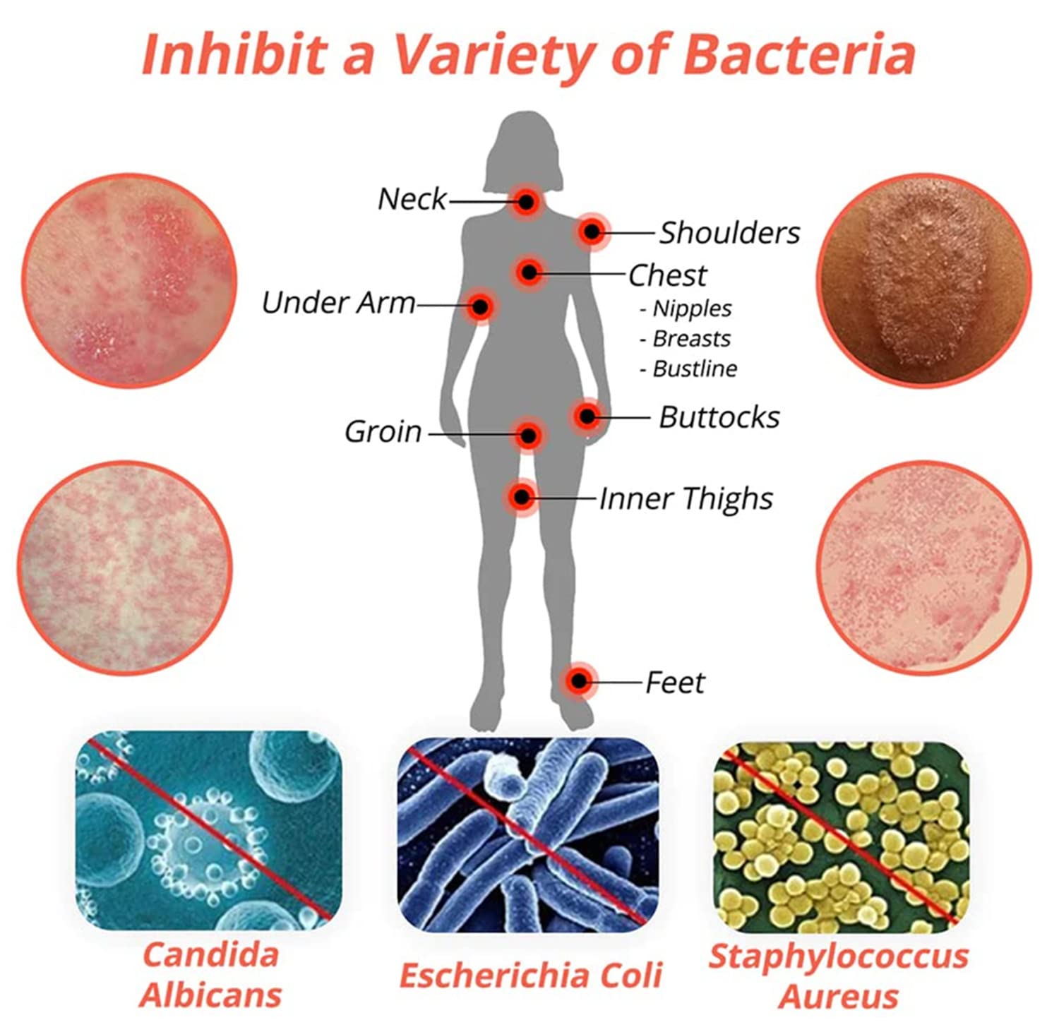 Home Remedies For Heat Rash Prickly Heat: Natural Remedies To Soothe