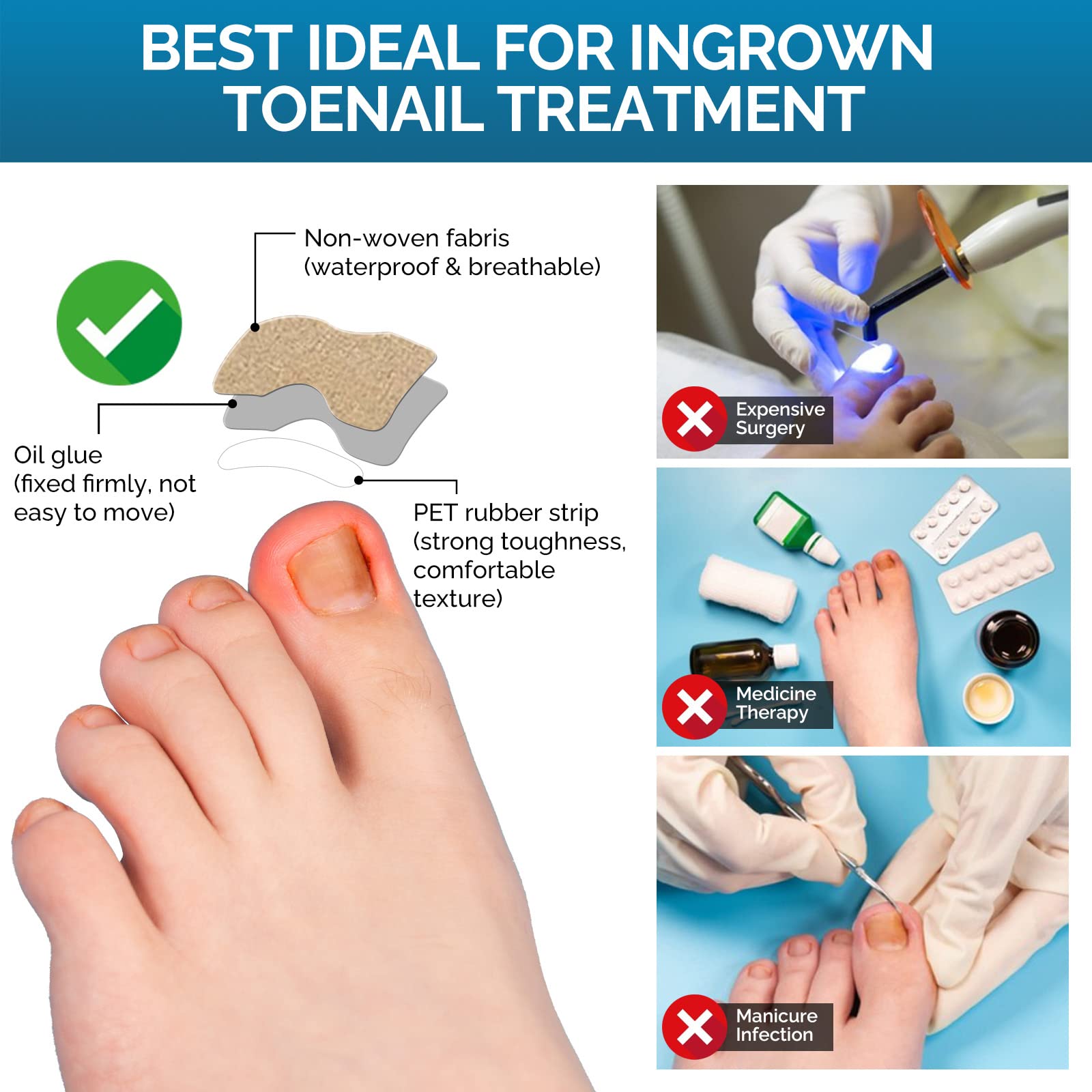 Medical Terminology For Ingrown Toenail