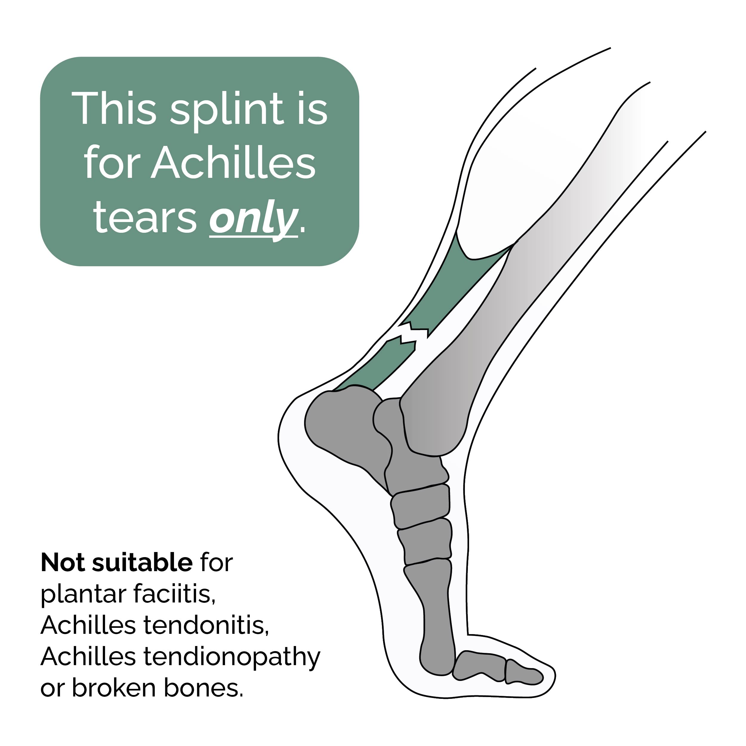 Achilles Tendon Rupture Recovery Get Fast Relief From Achilles